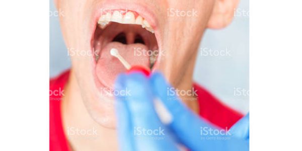 Pharma365 - Traitement ciblé des angines bactériennes