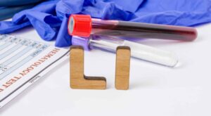 L’ANSM recommande de privilégier Téralithe 250 mg LI en initiation face ...